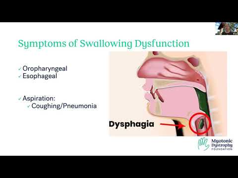 Managing Gastrointestinal (GI) Impacts of DM