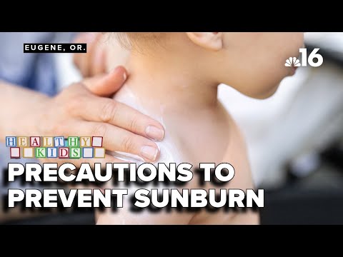 Healthy Kids: Take precautions to prevent sunburn in kids