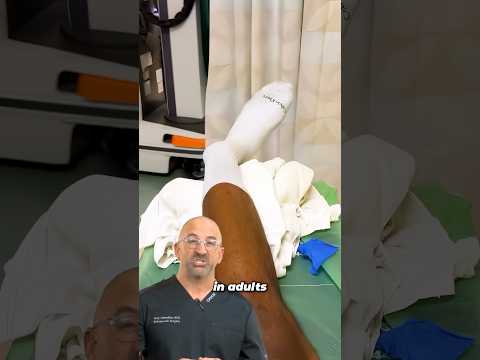 How To Maximize Ankle Fracture Recovery⁉️ #shorts