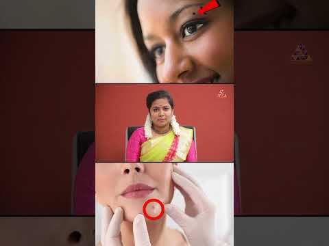 பெண்களுக்கு எங்கு மச்சம் இருந்தால் என்ன பலன்கள் | ராஜயோகம் பெண்களுக்கு உண்டா?