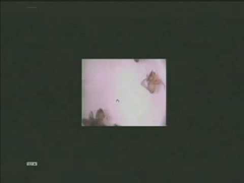 Fly Mutations and Anomolies in Perception