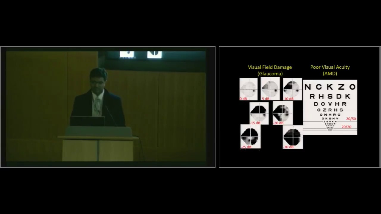 Physical Activity and Vision Loss–Bidirectional Causality