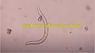 Worms In Poop Microscope Watch HD Mp4 Video Download Free