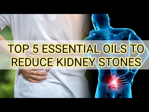 Top 5 Essential Oils to Reduce KIDNEY STONES | SelfLove