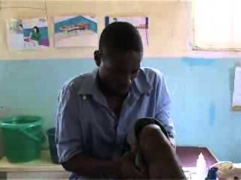 Cameroun: Ulcère de Buruli [Médecins Sans Frontières]