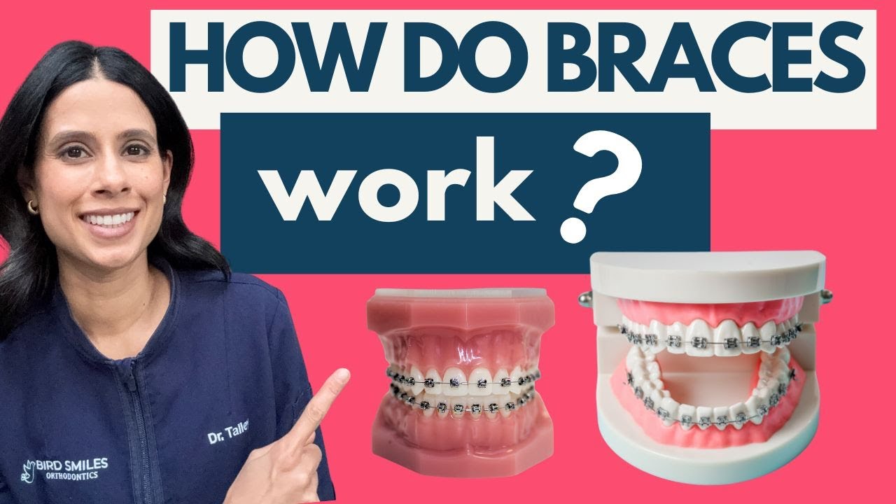 Dentist Reveals How Braces REALLY Work To Fix Crooked Crowded Teeth