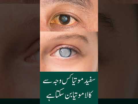 Can untreated cataracts lead to glaucoma | in Urdu Hindi