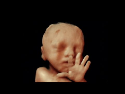Detailed anomaly scan