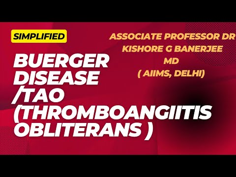 Why Buerger Disease is called Thromboangiitis Obliterans (TAO)?? #BuergerDisease #TAO #medicine #md