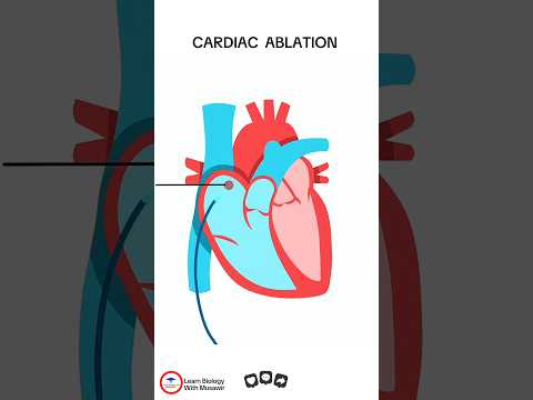 Cardiac Ablation #cardiology