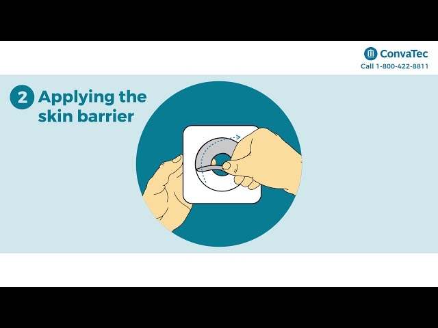 Colostomy Plates - 45mm 413161 Convatec Durahesive Base Plate ...