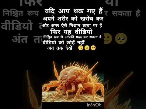Skin itch caused by itch mite# bi #facts #viralvideo #viralreels #viralshorts#insects #animals #love