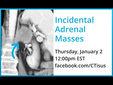 Facebook Live: Incidental Adrenal Masses