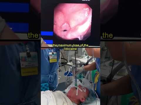 Flexible Bronchoscopy and Bronchoalveolar Lavage (BAL) #hospital #meded #surgeon #PGY #fyp #gensurg