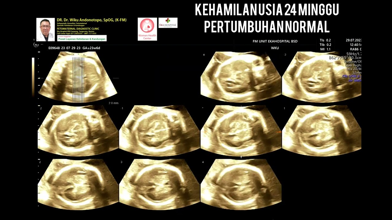 Pemeriksaan kehamilan 24 minggu