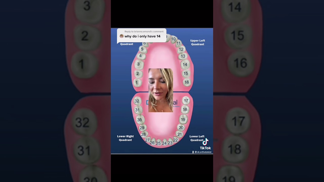 Tooth numbers #shorts #braces #teeth #orthodontist