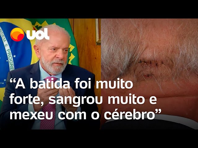 Lula conta como foi queda no banheiro em que bateu a nuca