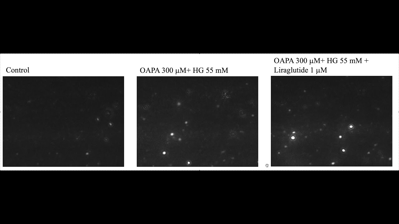 Exosome nanoparticle tracking (NTA).