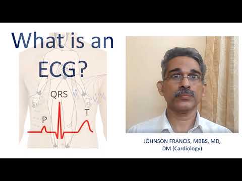 What is an ECG?