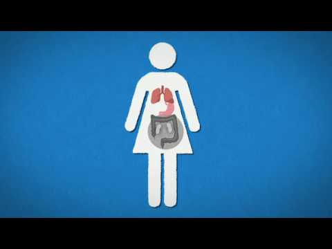 Qu'est-ce que le cancer?