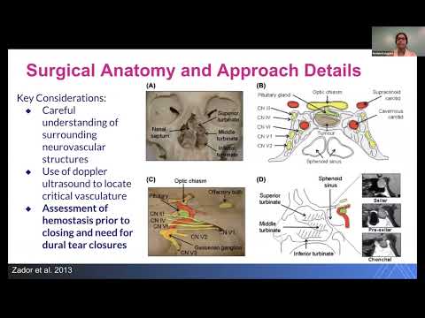 Pituitary Adenomas: Diagnosis and Management by Sheena Kalagara