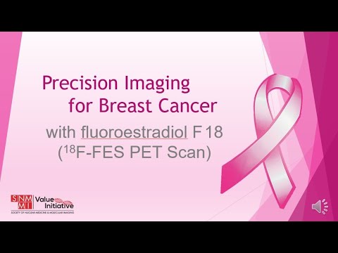 Precision Imaging for Breast Cancer