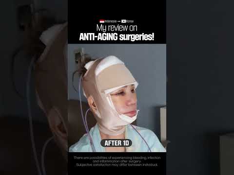 My facelift journey from Indonesia to Korea