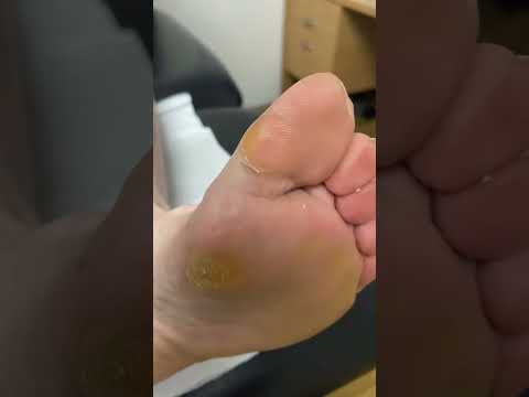 Embark on a toe-tal transformation journey with our Aussie podiatrist!