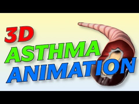 New 3D Asthma Medical Animation (Causes and Treatment) – Breathing ...