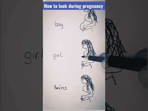 shapes of stomach during pregnancy. #shorts #medical #nursing #pregnancy #viral