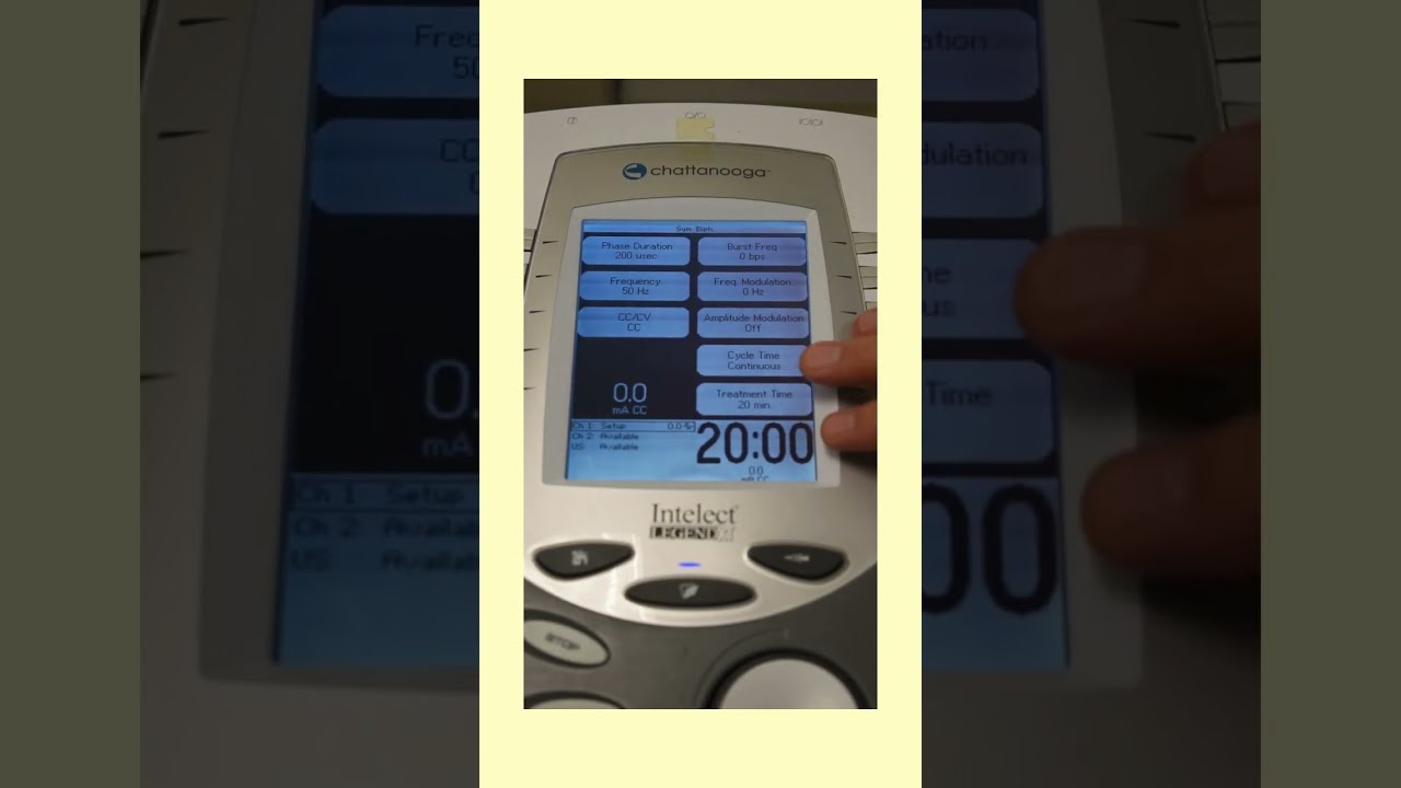 NMES Setup Explained | E-stim Parameters Simplified