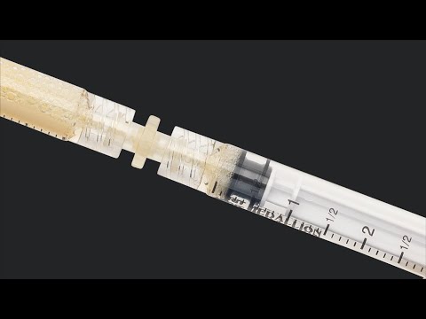 Treatment of Peroneal Tendinopathy and Tears With Interfyl® Connective Tissue Matrix