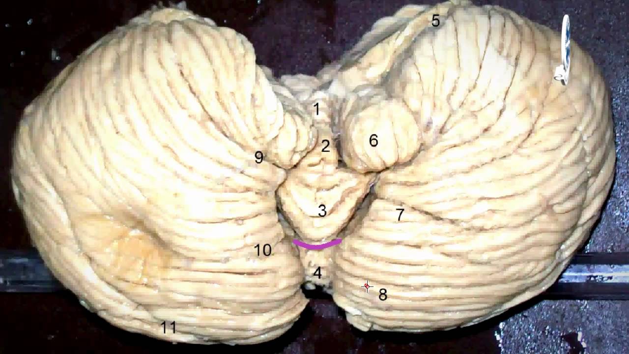 Cerebelo
