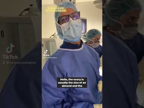 Large ovarian cyst!