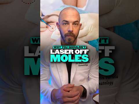Should you laser your moles? Derm explains why this is a BAD idea! #laser #moles