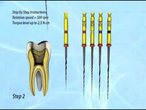 Healix ConMem NiTi Rotary Files | pinkblue