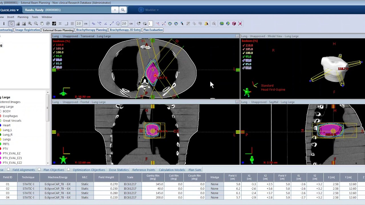 Introducing: EZFluence