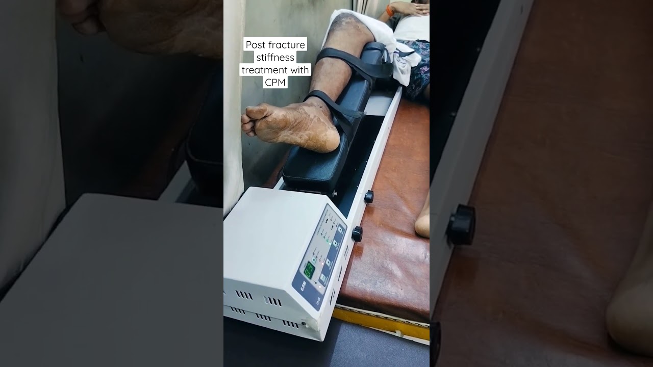 post fracture stiffness treatment with CPM machine #postfracture #exercise #cpm #stiffness #knee