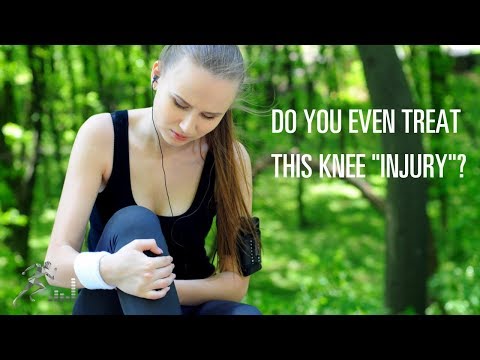 Bipartite patella: What is this knee finding, and what does it mean for you?
