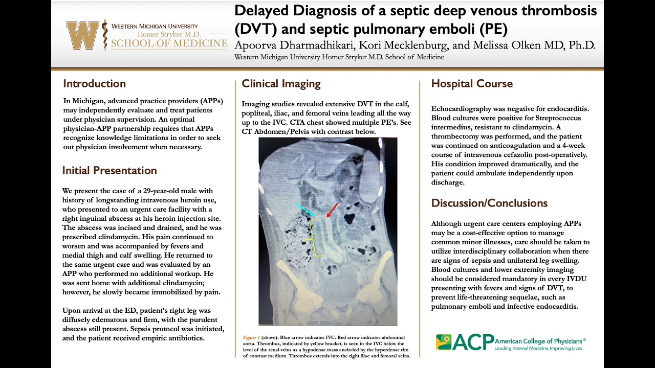 ACP Michigan Abstract Presentation