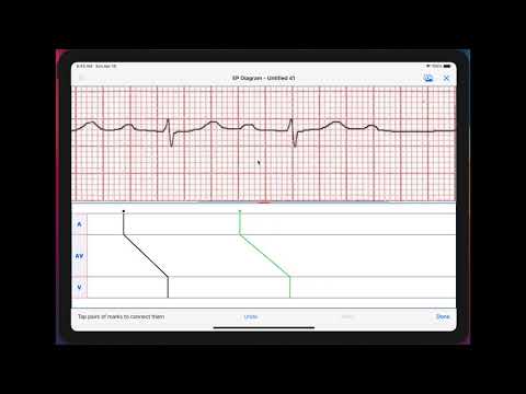Introducing EP Diagram – EP Studios