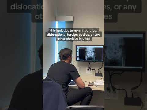 New patient x-ray evaluations | What does an orthopedic surgeon look for? | The Wright Surgeon