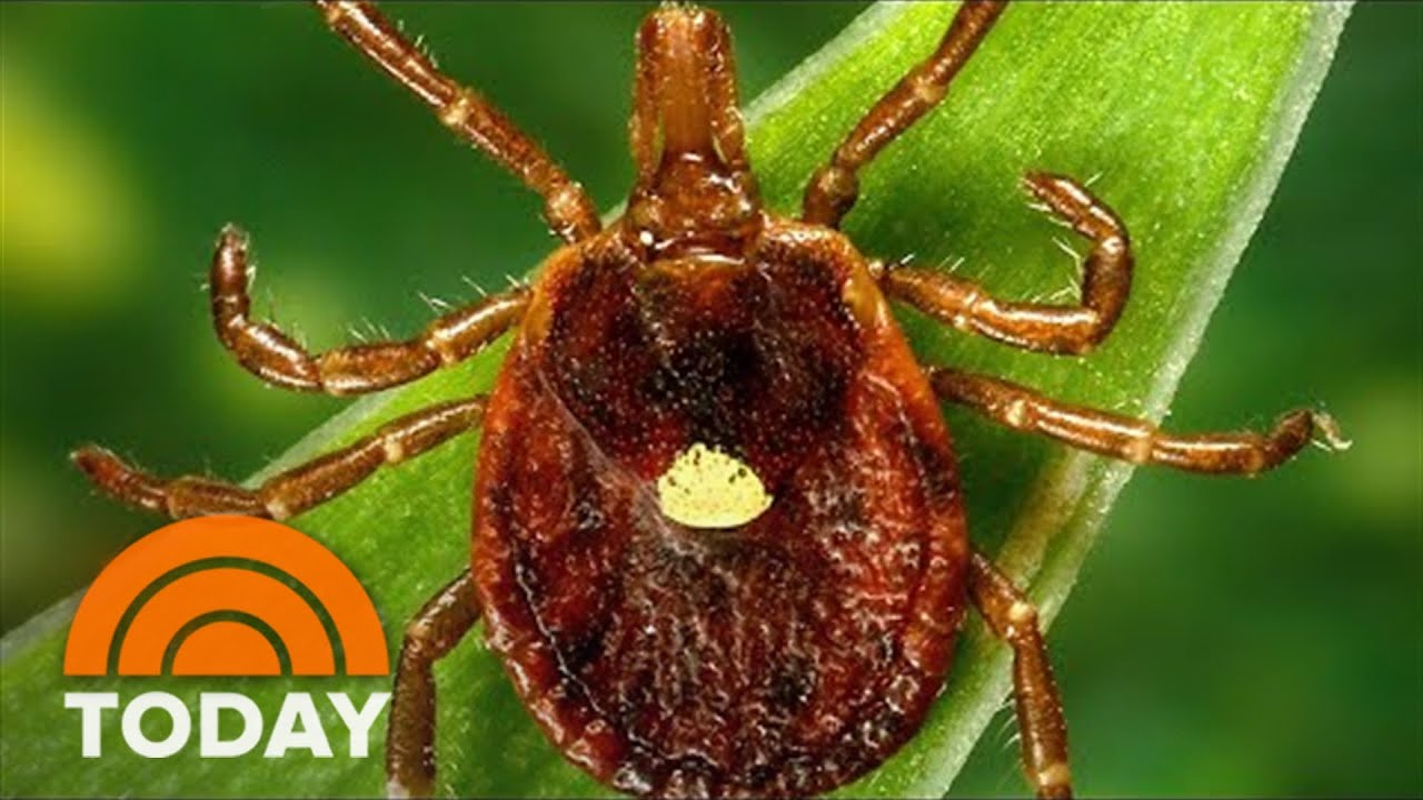 How A Bite From A 'Lone Star' Tick Can Trigger Severe Allergy To Meat