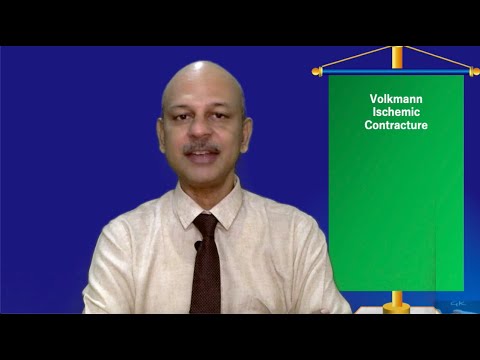 Tips and Tricks Series in Hand Surgery: Volkmann Ischemic Contracture