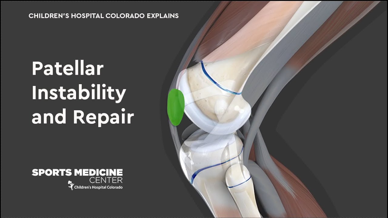 Patellar Instability and Repair
