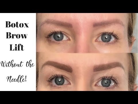 Get The Look Of A BOTOX BROW LIFT Using Makeup | Full Eyebrow Tutorial