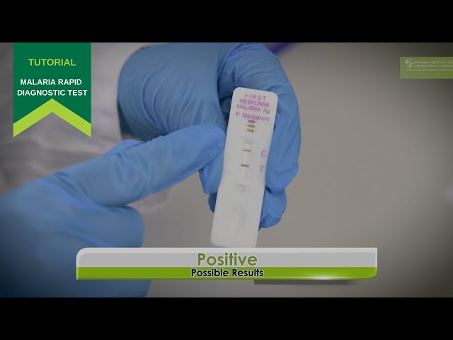 Diagnostic Kits - Hiv Rapid Diagnostic Test Kits Exporter from Bhiwani