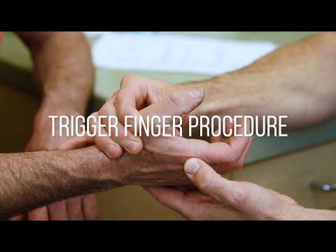 Treatment Options for Trigger Finger
