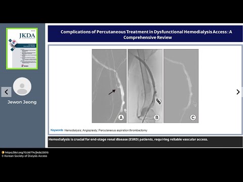 Complications of Percutaneous Treatment in Dysfunctional Hemodialysis Access A Comprehensive Review