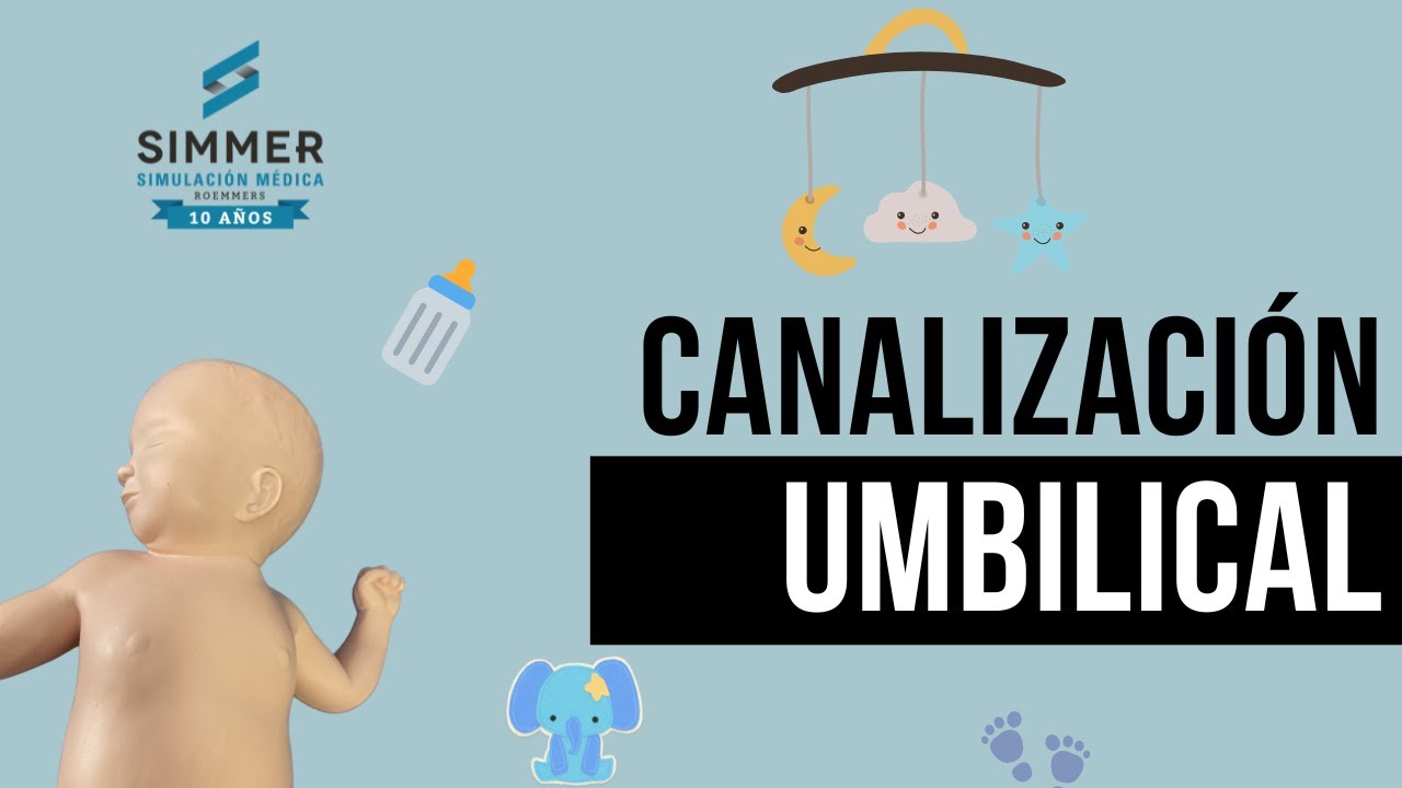 Canalización Umbilical - SIMMER